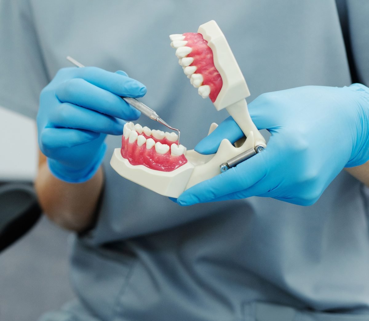 Benefits of dental charting - Dr. Salim Kapadia Dental Centre