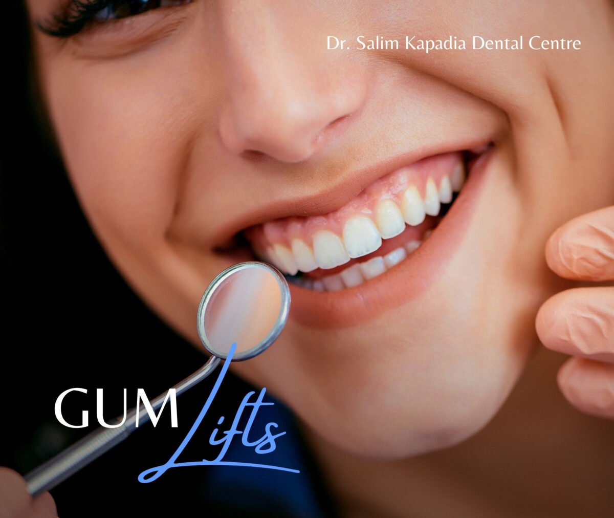 When to Consider a Gum Lift - Dr. Salim Kapadia Dental Centre