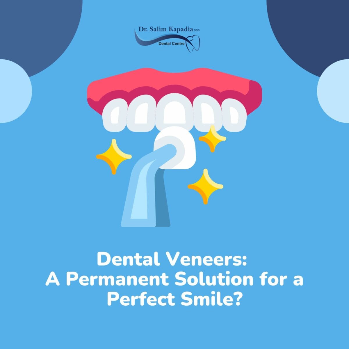 Dental Veneers: A Permanent Solution for a Perfect Smile? - Dr. Salim ...