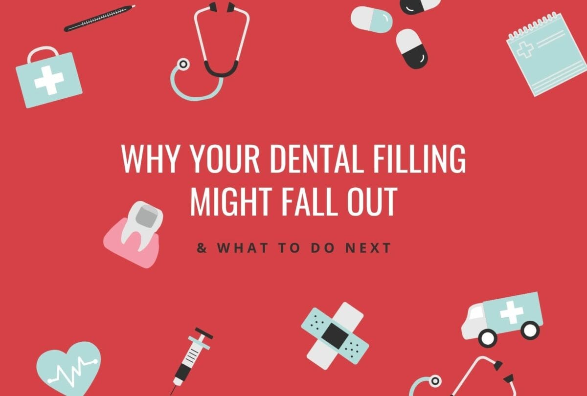 Why Your Dental Filling Might Fall Out & What to Do Next - Dr. Salim ...